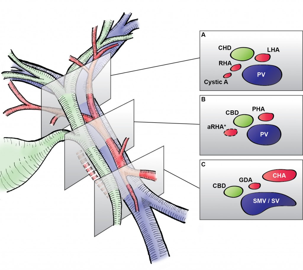 Anatomy of the extra-hepatic biliary tree – DataSurg